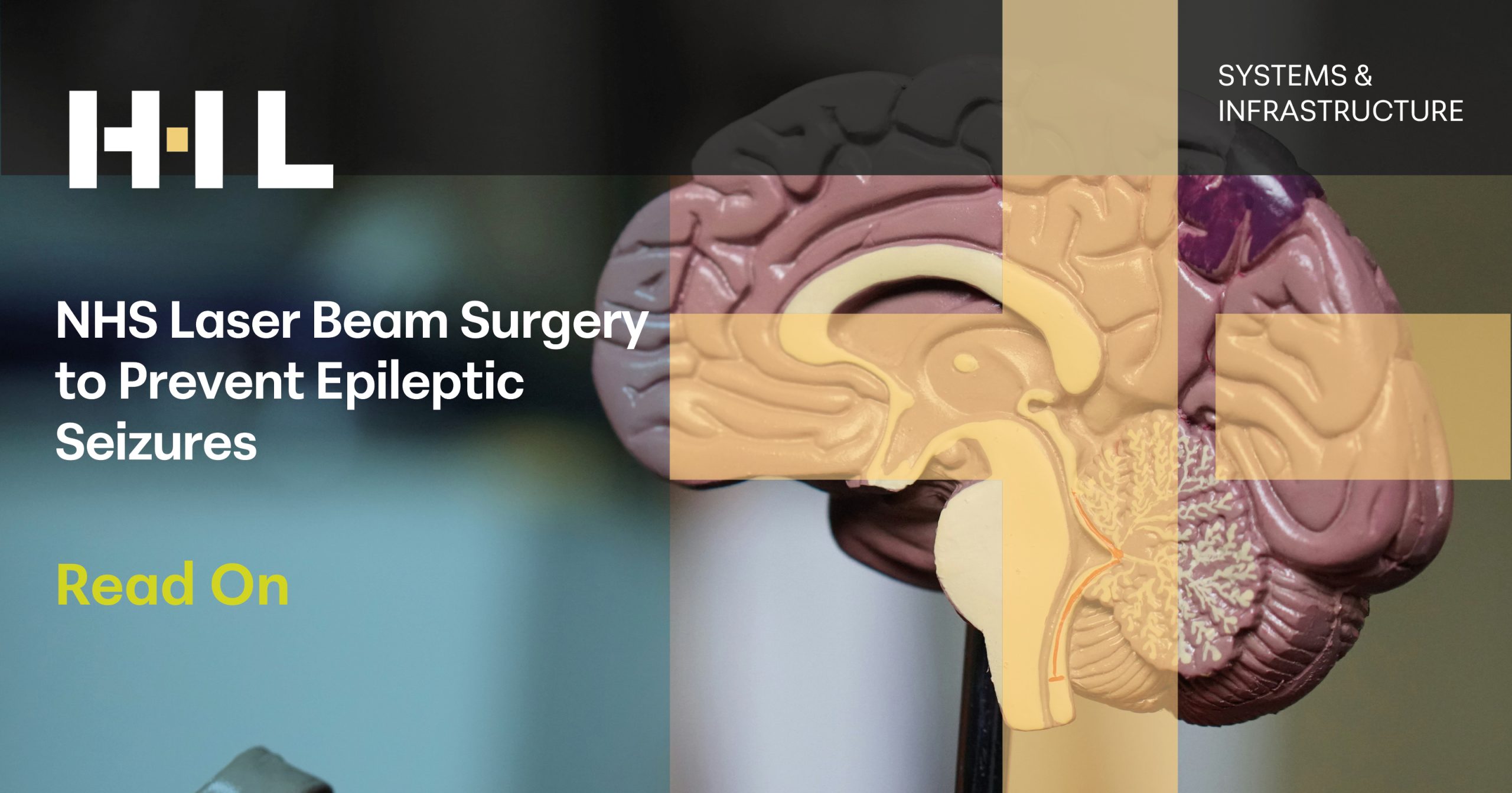 NHS Laser Beam Surgery to Prevent Epileptic Seizures - Health Industry ...